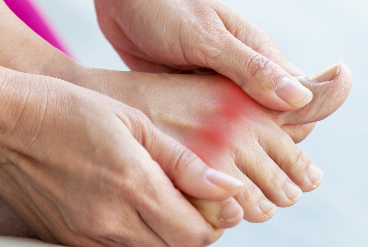 Ako sa stravovať pri dne? Aké sú príčiny a príznaky ochorenia ...