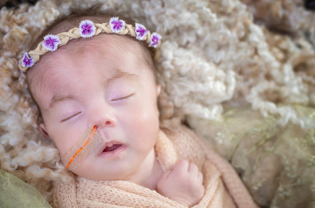 Edwardsov syndróm – genetická porucha so zlou prognózou - TvojeZdravie.sk