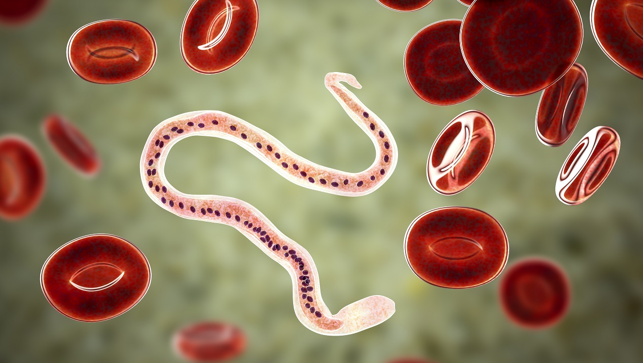 Parazity v tele – 9 príšer, s ktorými sa nechcete stretnúť ...