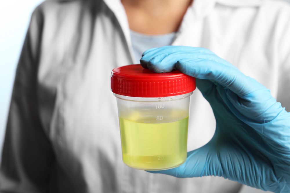 Uroflowmetria: Diagnostika problémov s močovým mechúrom - TvojeZdravie.sk